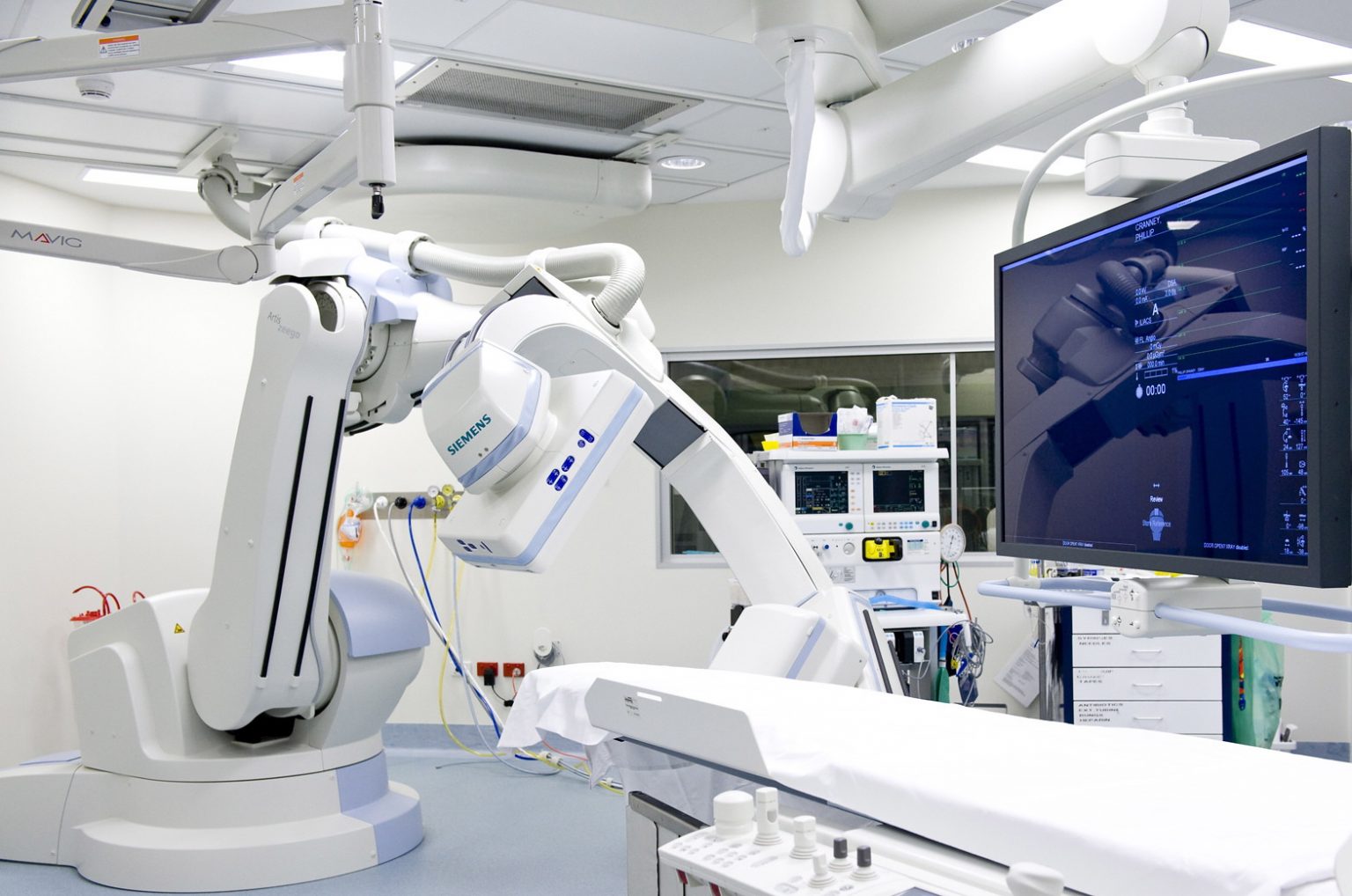 Cáteter implantable para quimioterapia